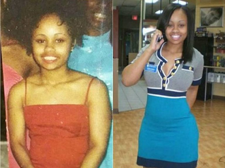 Desde Arriba Blac Chynas Before And After Photos Tell The Real Deal With Her Plastic Surgery